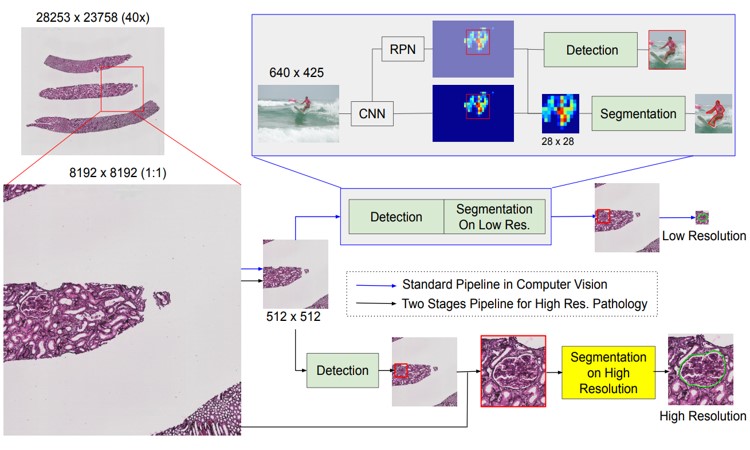 Instance Segmentation for Whole Slide Imaging: End-to-End or Detect ...