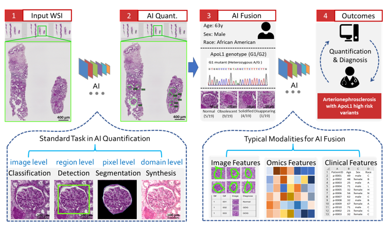 AI Applications in Renal Pathology | HRLB Lab