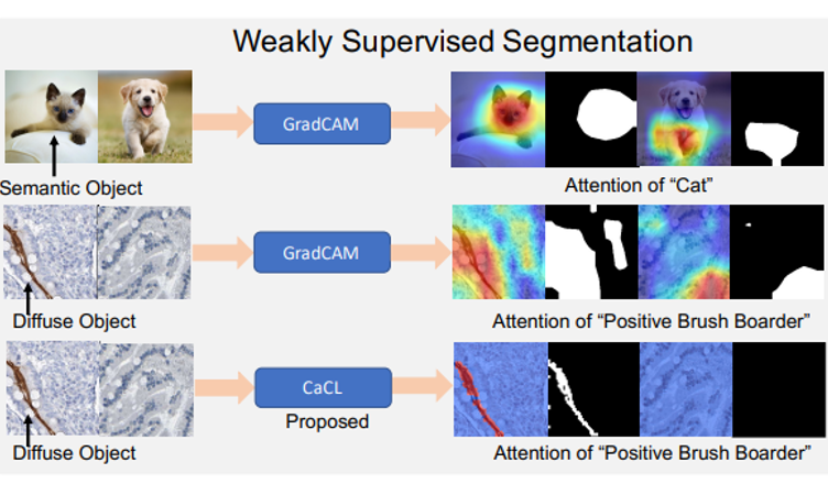 CaCL: Class-aware Codebook Learning for Weakly Supervised Segmentation ... CaCL: Class-aware Codebook Learning for Weakly Supervised Segmentation ...
