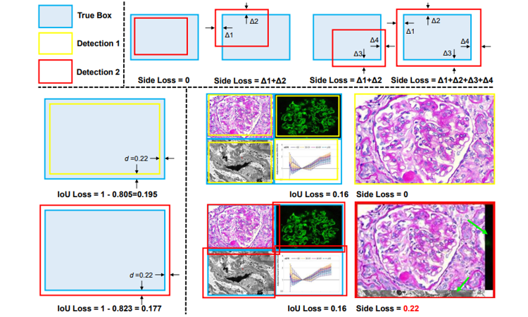 Compound Figure Separation of Biomedical Images with Side Loss | HRLB Lab