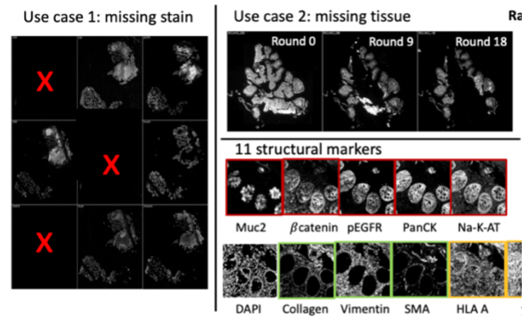 Random Multi-Channel Image Synthesis for Multiplexed Immunofluorescence ...