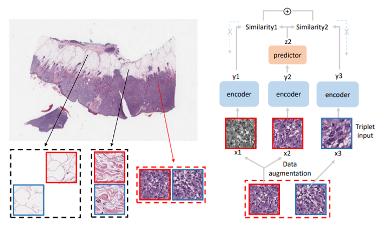 SimTriplet: Simple Triplet Representation Learning with a Single GPU | HRLB Lab