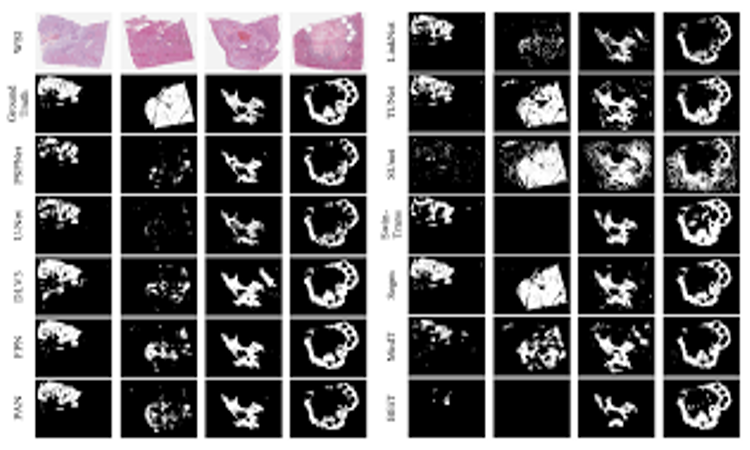 Evaluating Transformer Based Semantic Segmentation Networks For Pathological Image Segmentation