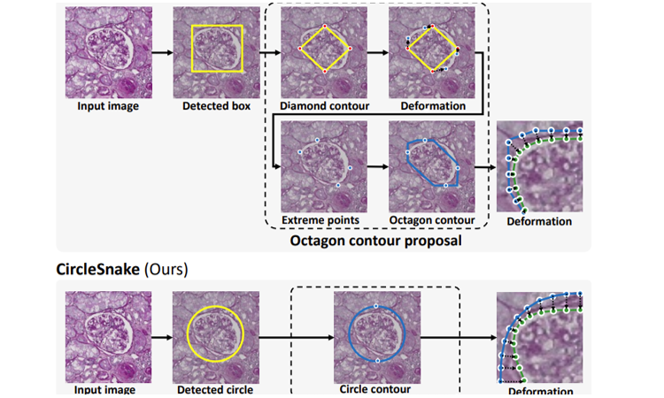 CircleSnake: Instance Segmentation with Circle Representation | HRLB Lab