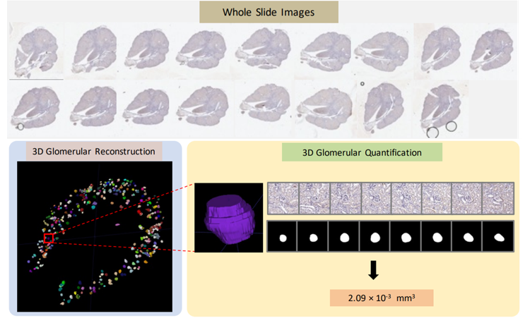 Dense Multi-object 3D Glomerular Reconstruction and Quantification on 2D Serial Section Whole ...