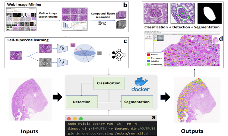 Glo-In-One: Holistic Glomerular Detection, Segmentation, and Lesion ...