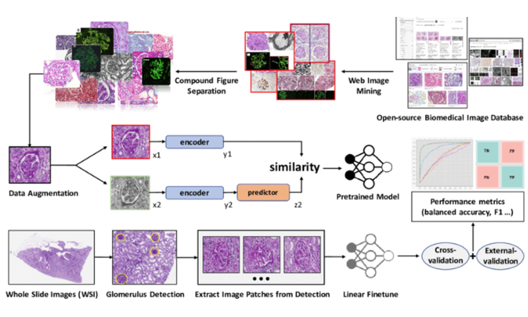 Self-supervised Learning with Large-scale Web Image Mining for Characterizing Glomerular Lesion ...