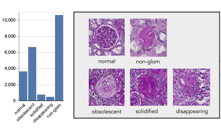 Holistic Fine-grained GGS Characterization: From Detection to ...