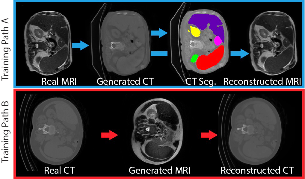 Synseg-net: Synthetic segmentation without target modality ground truth | HRLB Lab